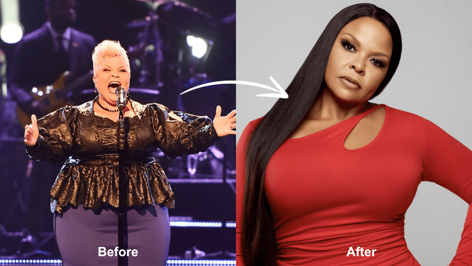 Did Tamela Mann Have Weight Loss Surgery? - Bariatric Journal