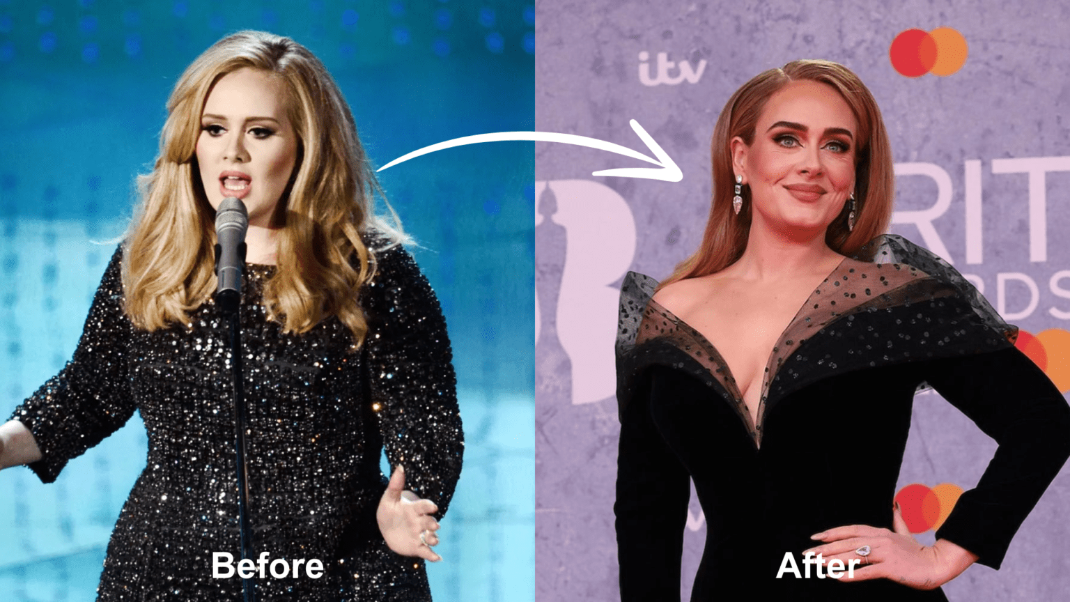 Did Adele Have Weight Loss Surgery? - Bariatric Journal