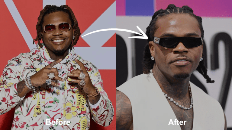 Did Gunna Have Weight Loss Surgery? - Bariatric Journal