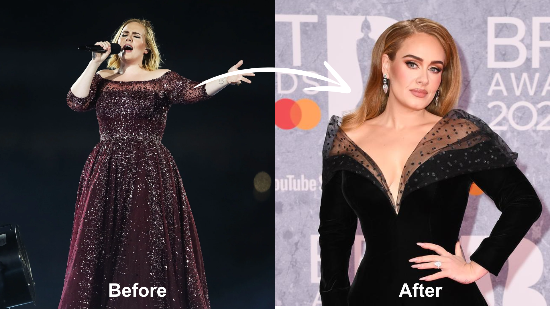 Did Adele Have Weight Loss Surgery? - Bariatric Journal
